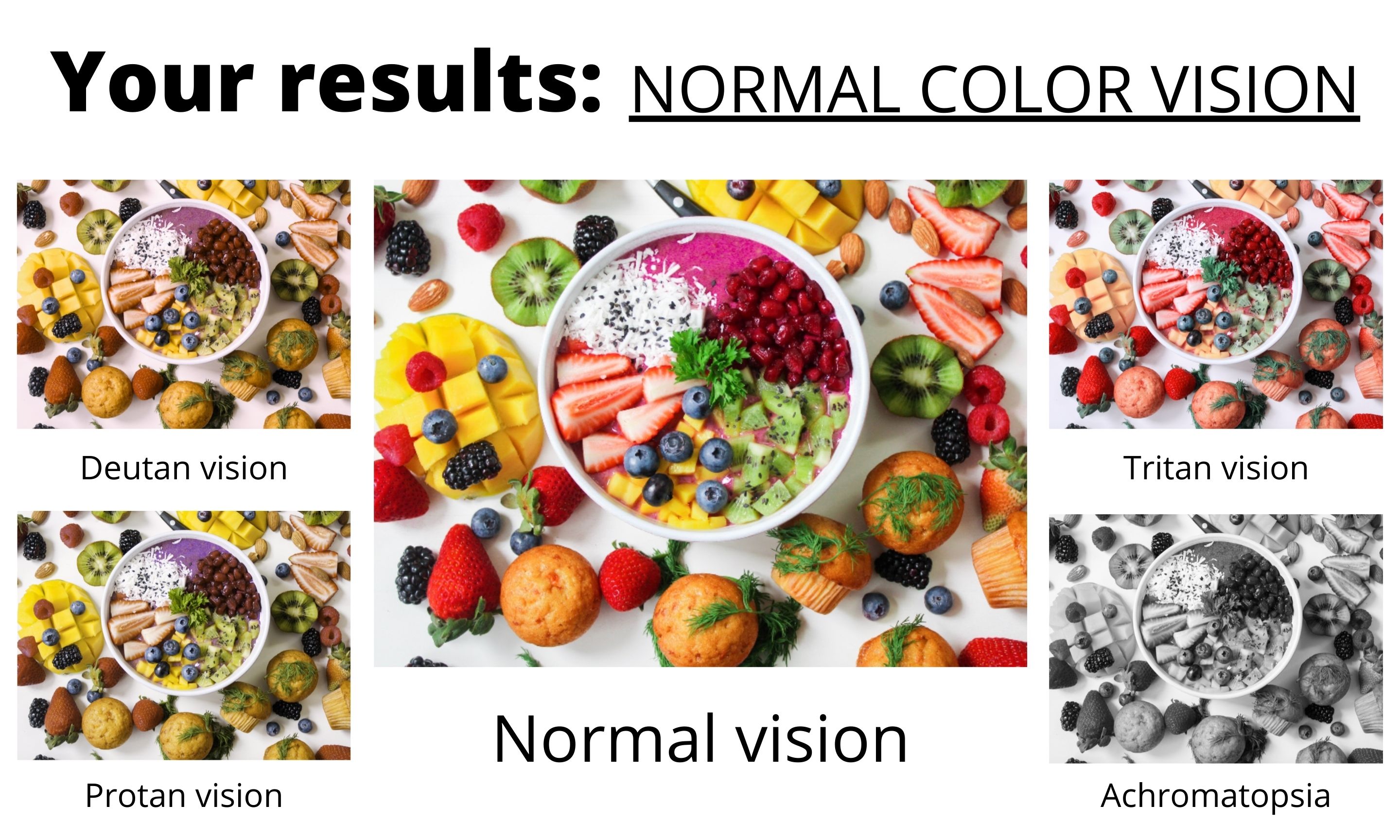 Normal Vision Normal Vision